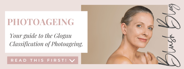 The Glogau Wrinkle Scale and Photoaging: A Guide for Professional Skin ...