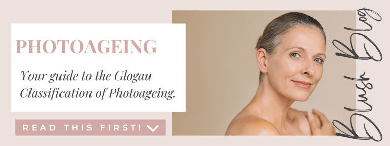 The Glogau Wrinkle Scale and Photoaging: A Guide for Professional Skin ...