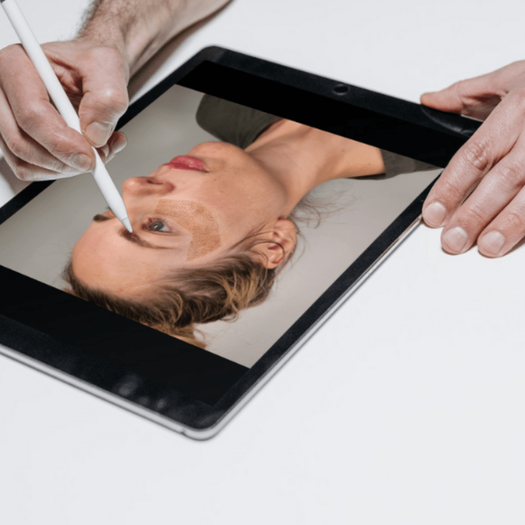 Plasma Fibroblast Mapping Practice Guide - Blush Academy