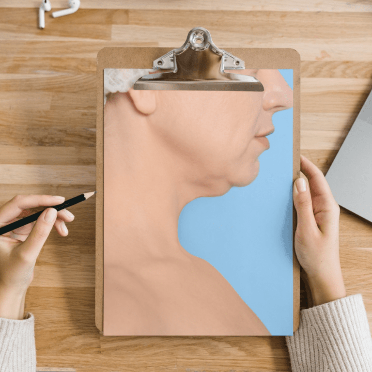 Plasma Fibroblast Mapping Practice Guide - Blush Academy